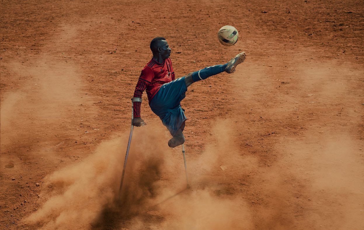 Photos of the amputee football team changing the game in… | Huck