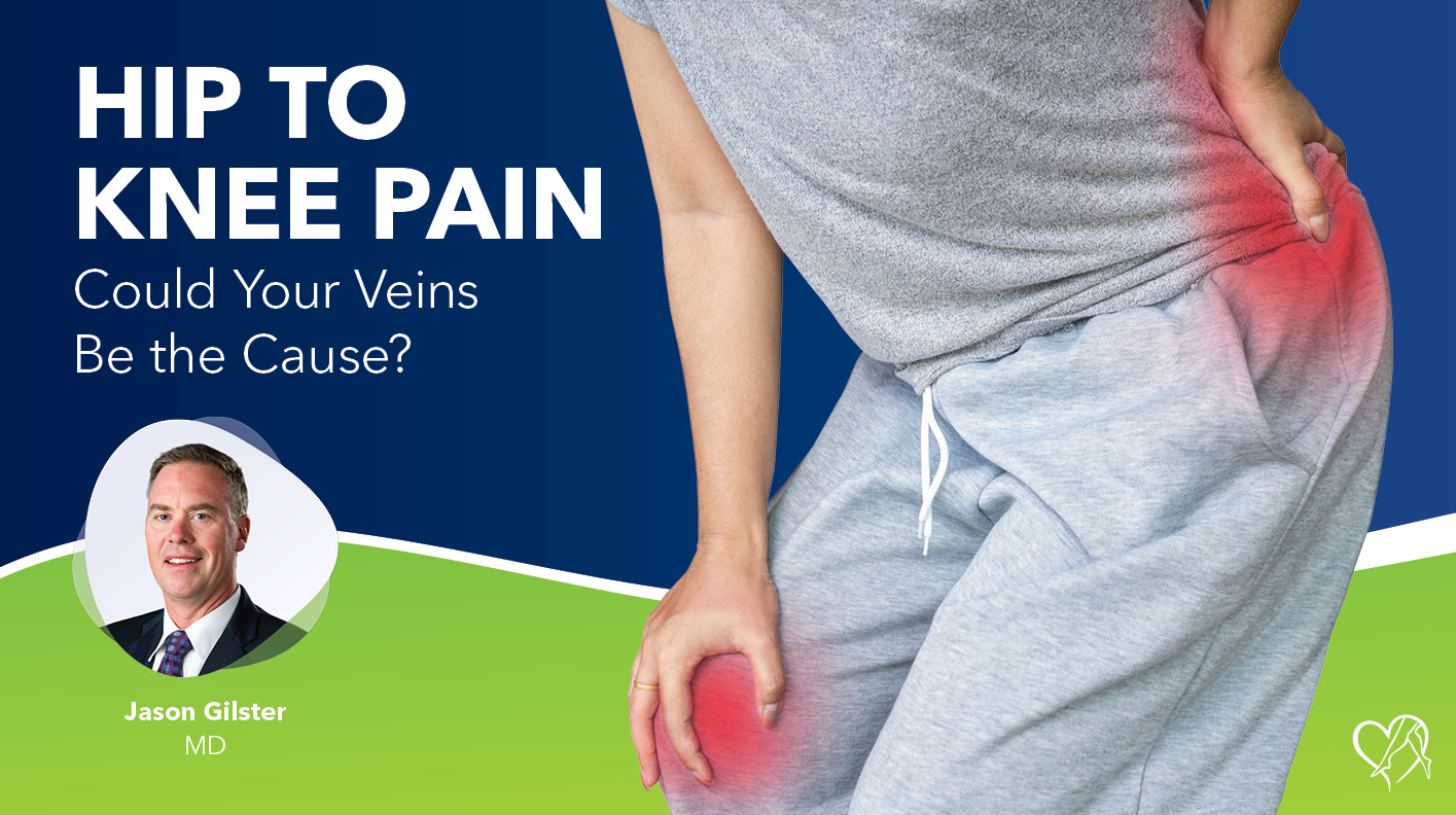 Hip to Knee Pain: Could Your Veins Be the Cause?