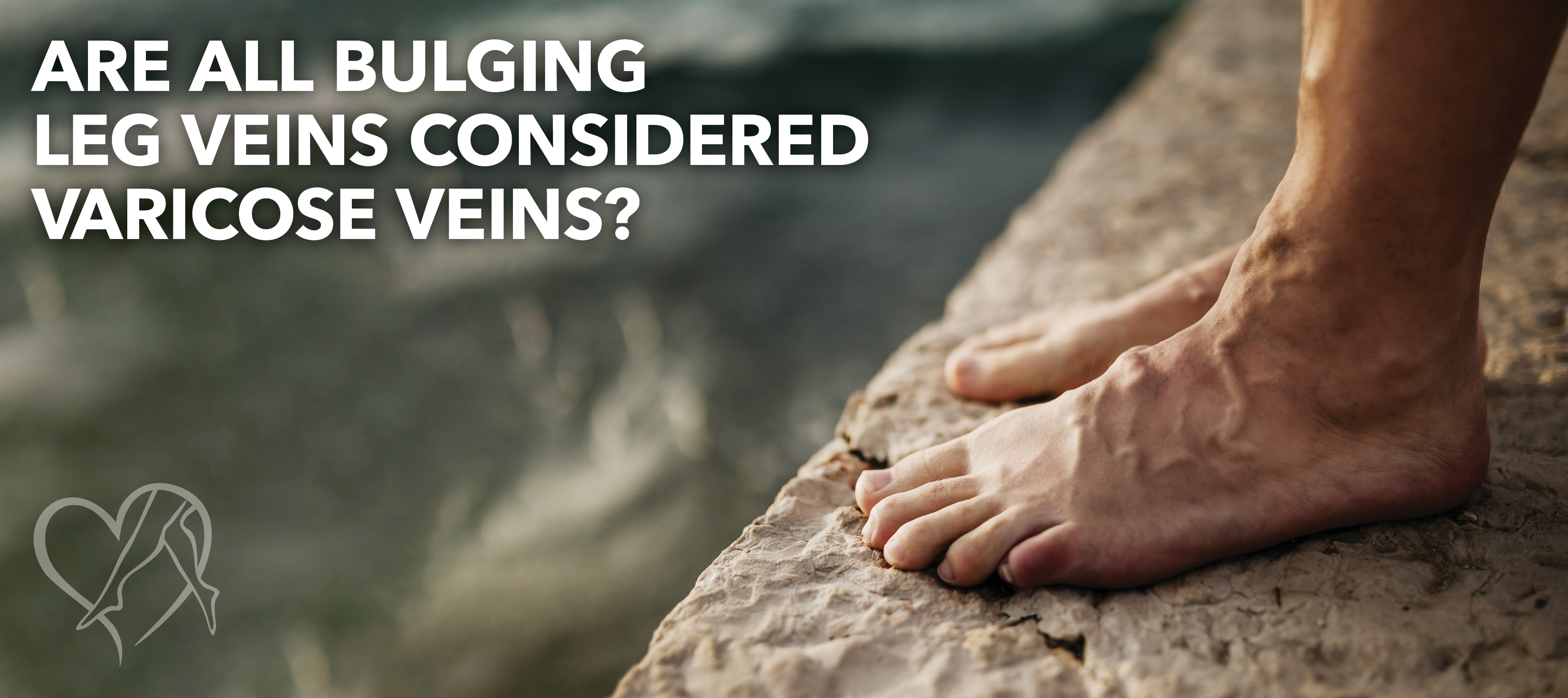 Are All Bulging Leg Veins Considered Varicose Veins?