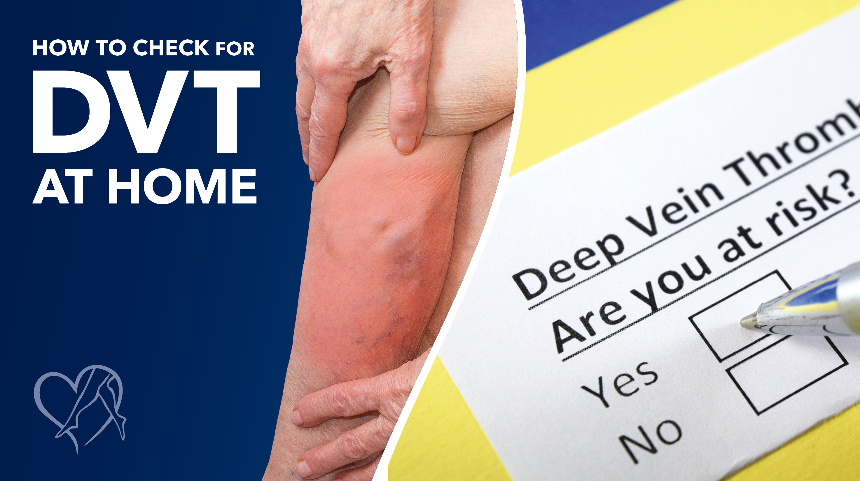 How to Check for Poor Blood Circulation at Home (and What to Do About It!)