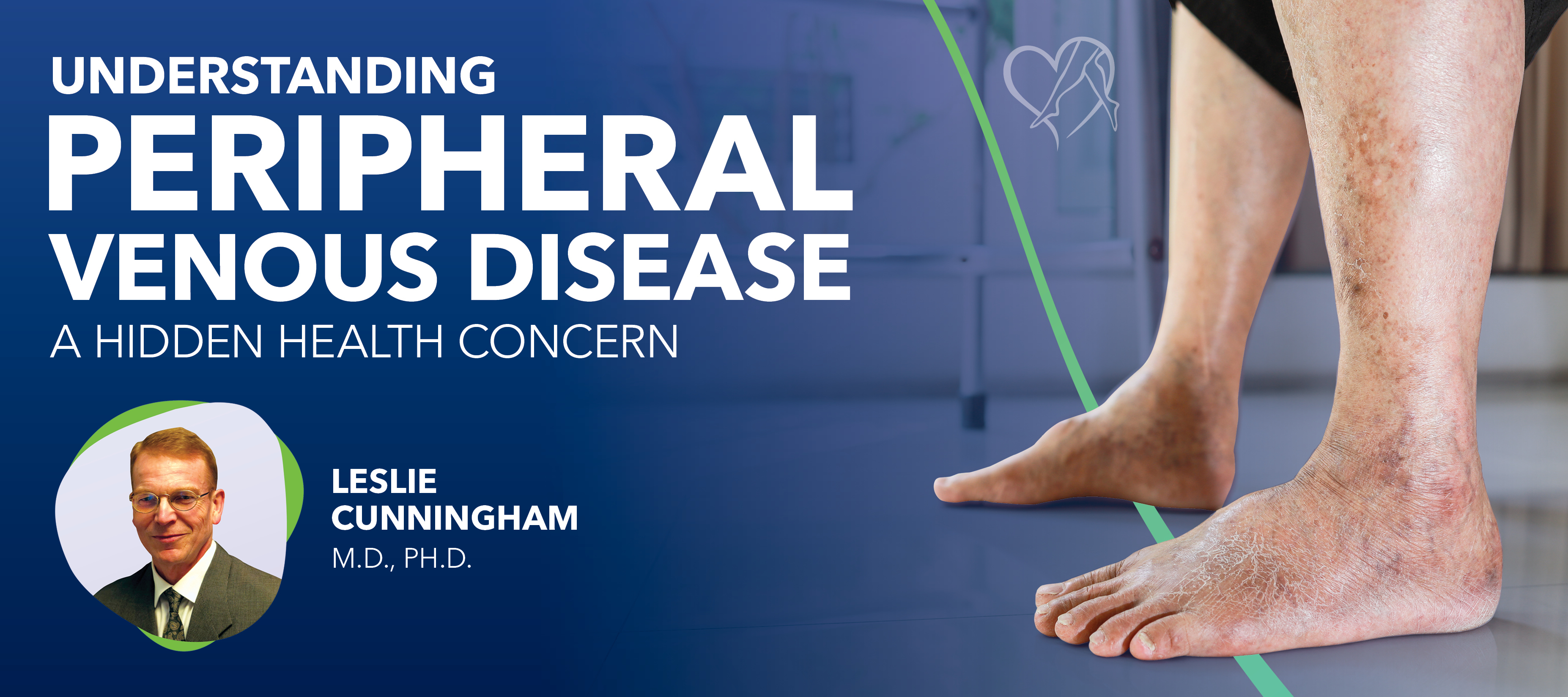 Understanding Peripheral Venous Disease: A Hidden Health Concern