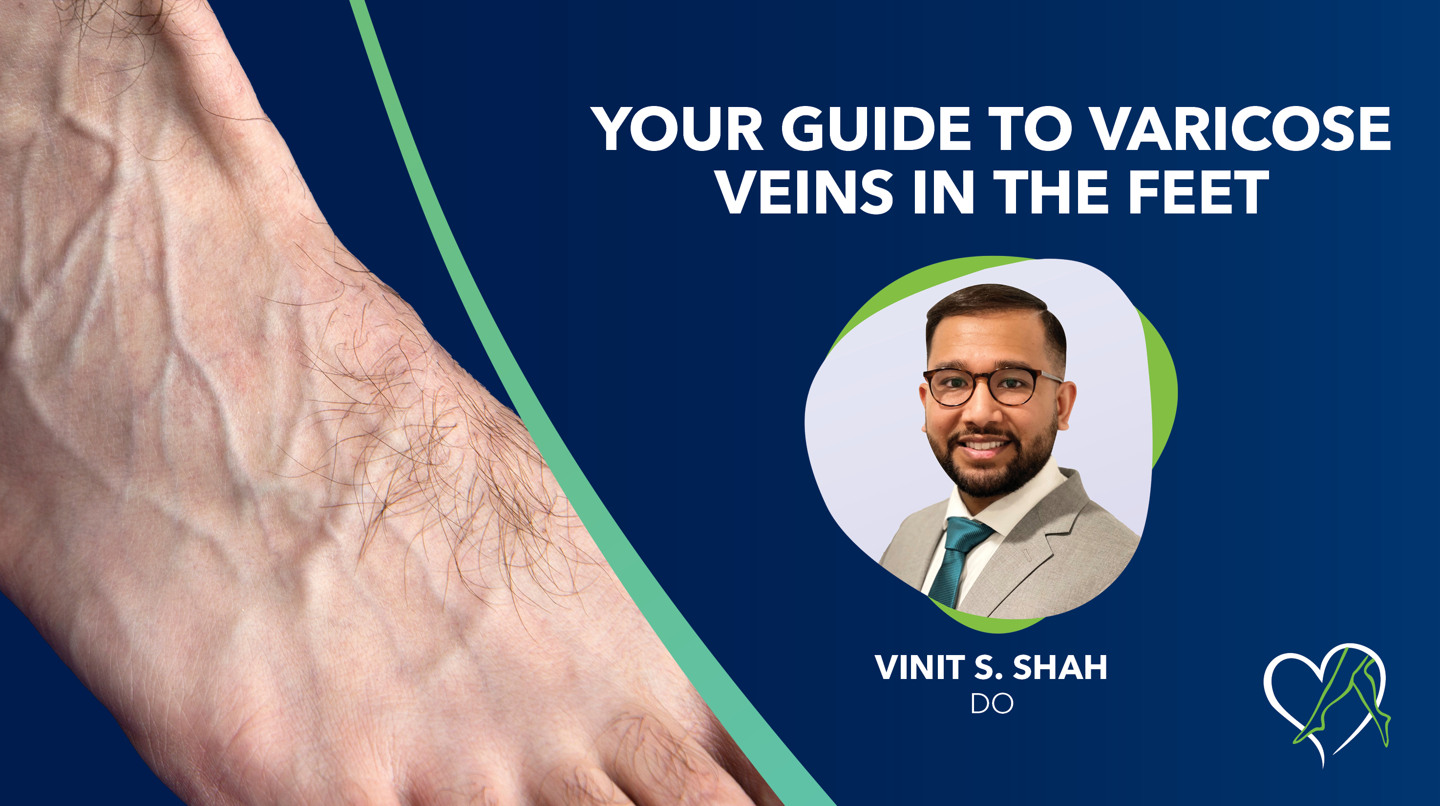 Center for Vein Restoration | ¿Por qué están sobresaliendo las venas de ...