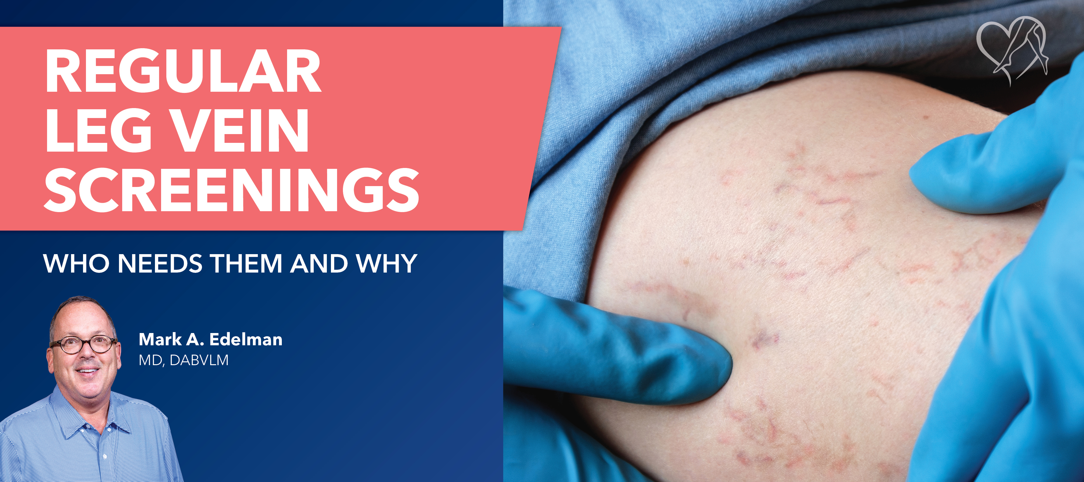 Regular Leg Vein Screenings: Who Needs Them and Why