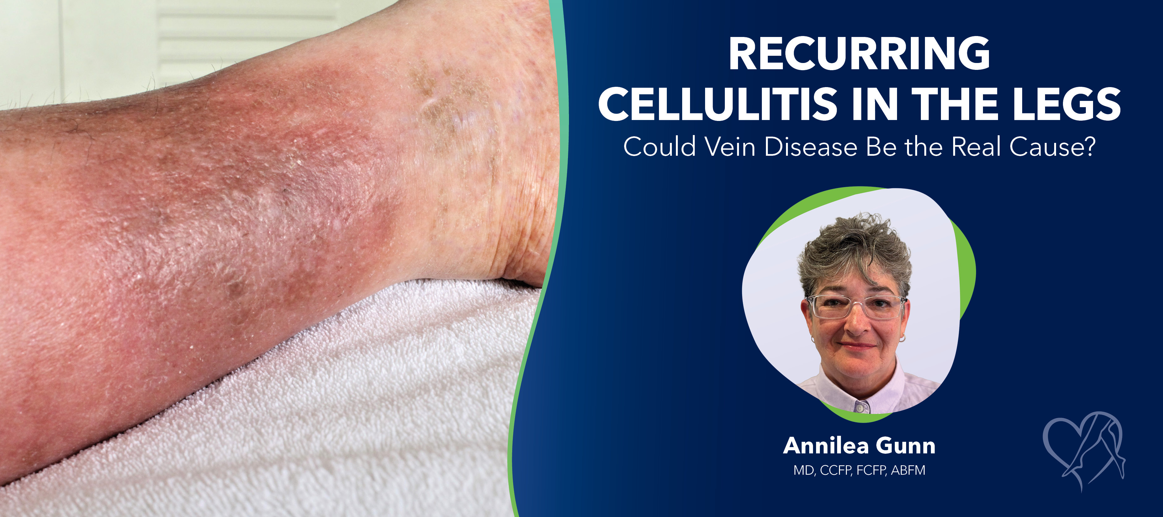 Recurring Cellulitis in the Legs: Could Vein Disease Be the Real Cause?