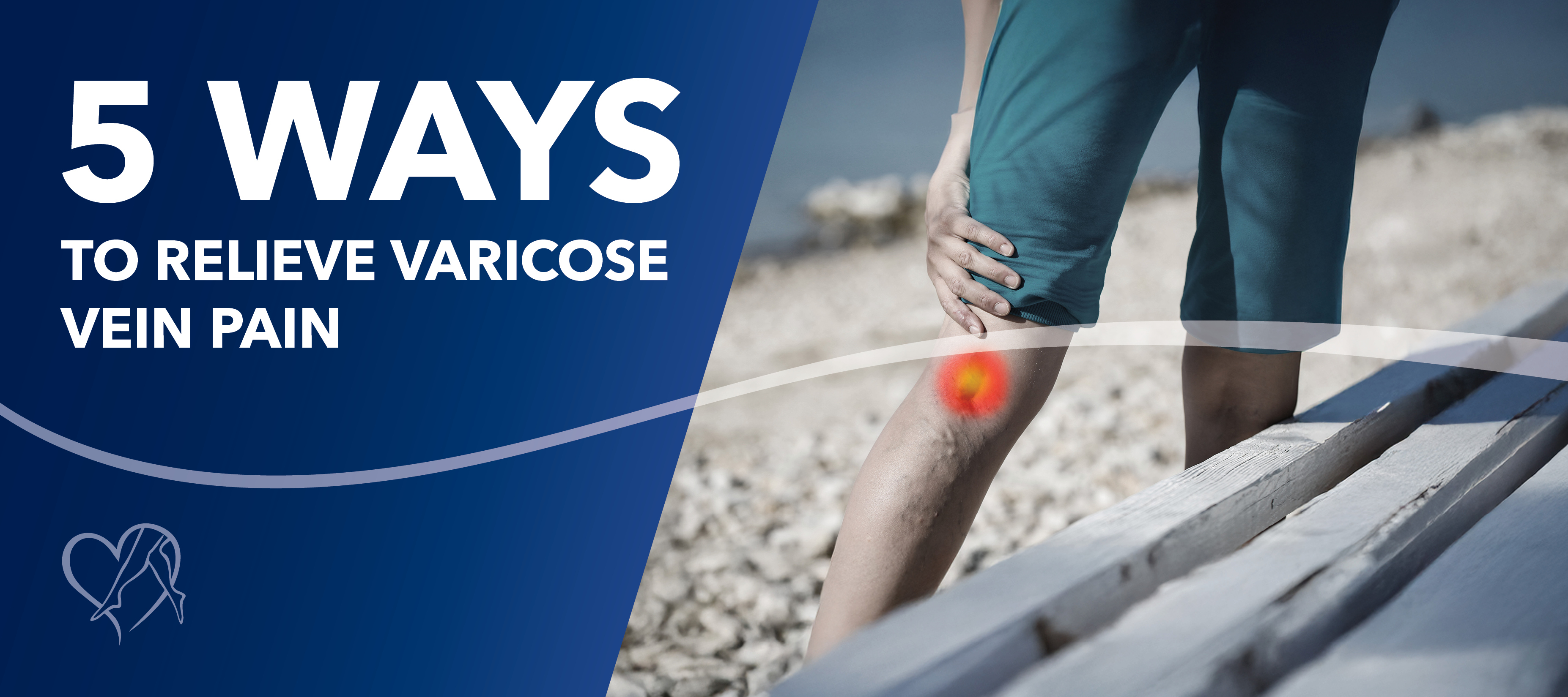 How to Relieve Pain Caused by Varicose Veins | CVR Blog