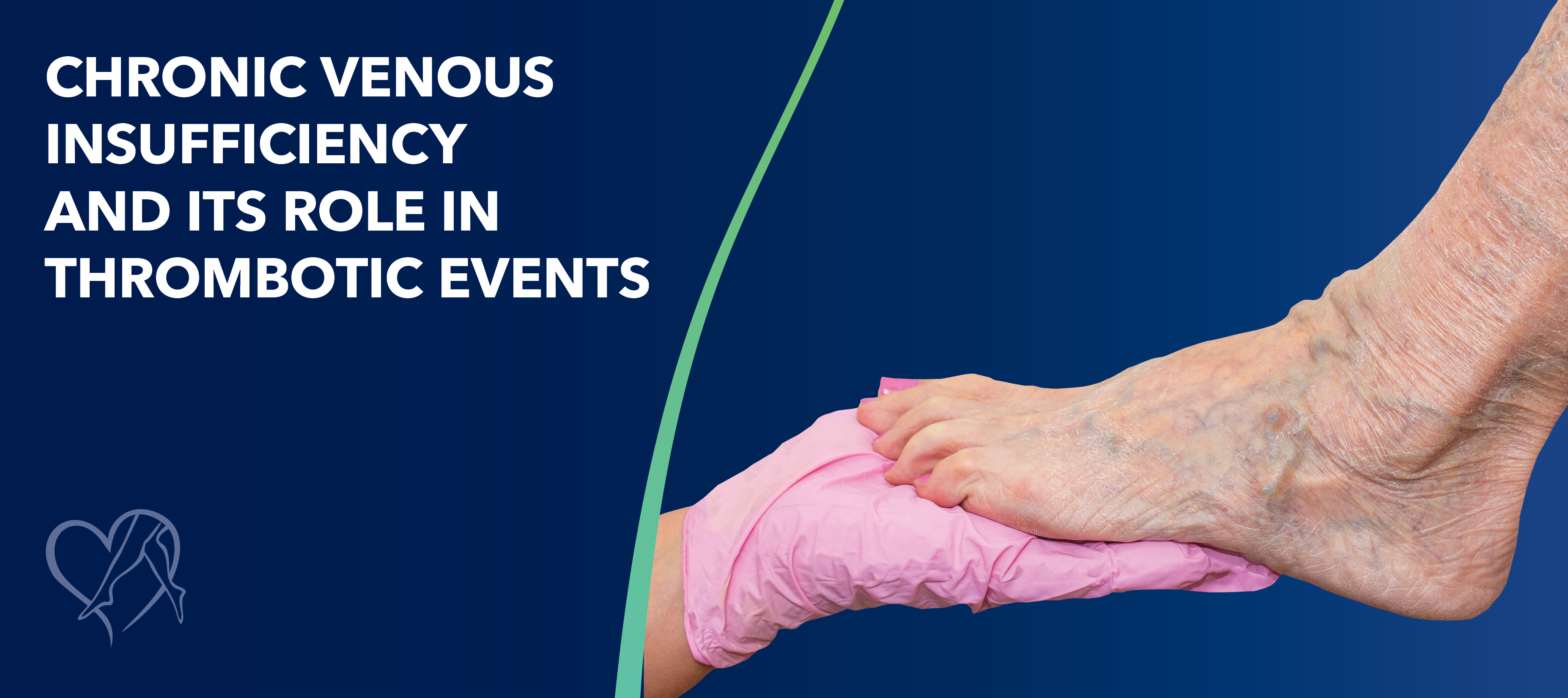 Chronic Venous Insufficiency and Its Role in Thrombotic Events