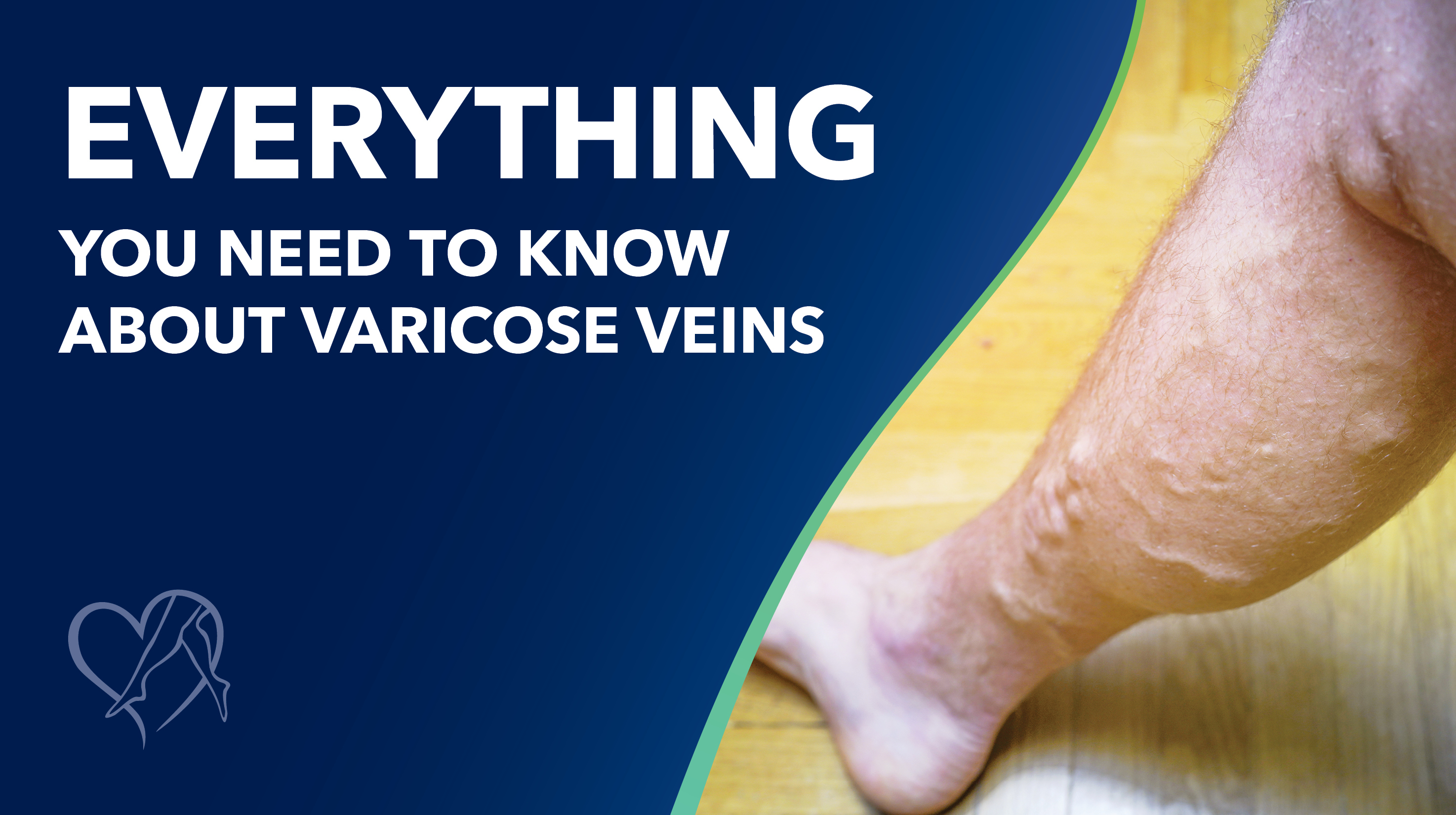 Center for Vein Restoration | Learn About Vein Conditions & Treatments ...