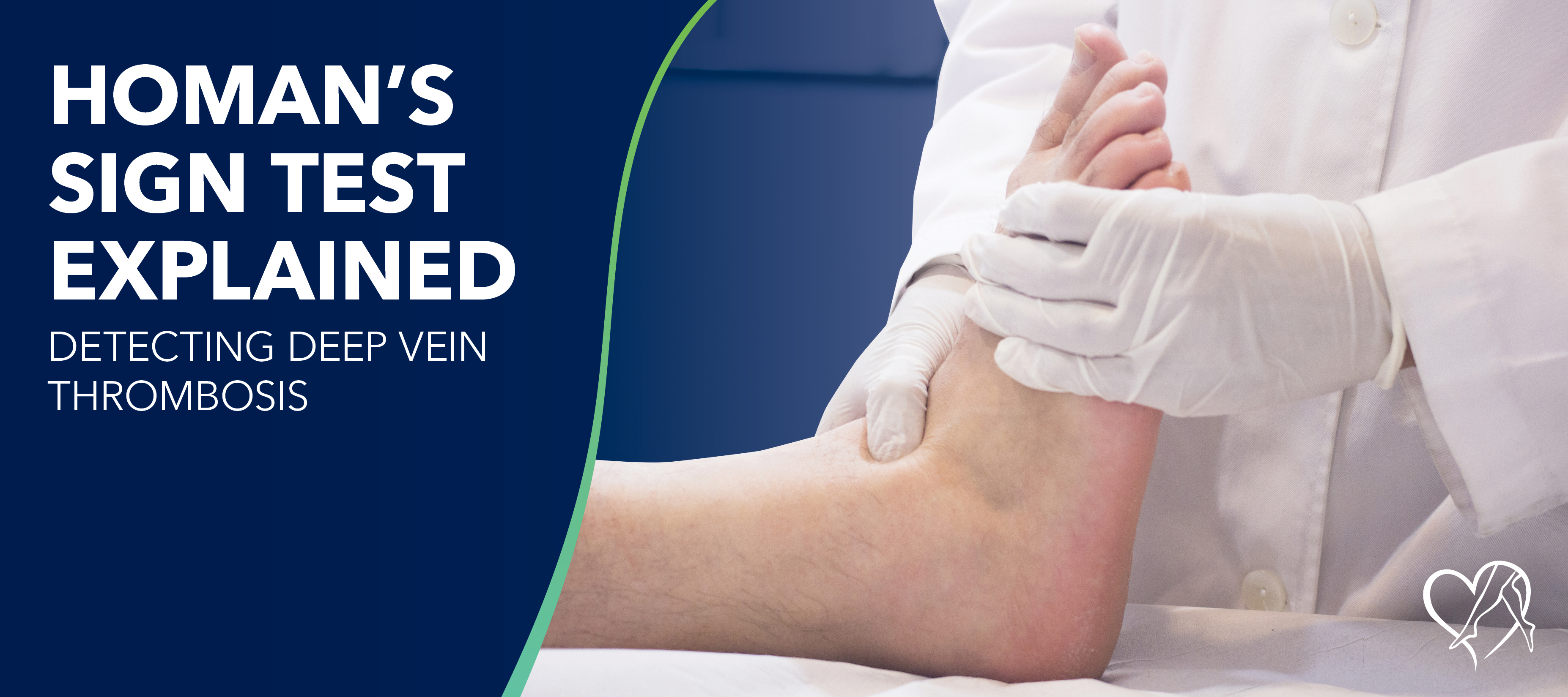 Homan’s Sign Test Explained: Detecting Deep Vein Thrombosis