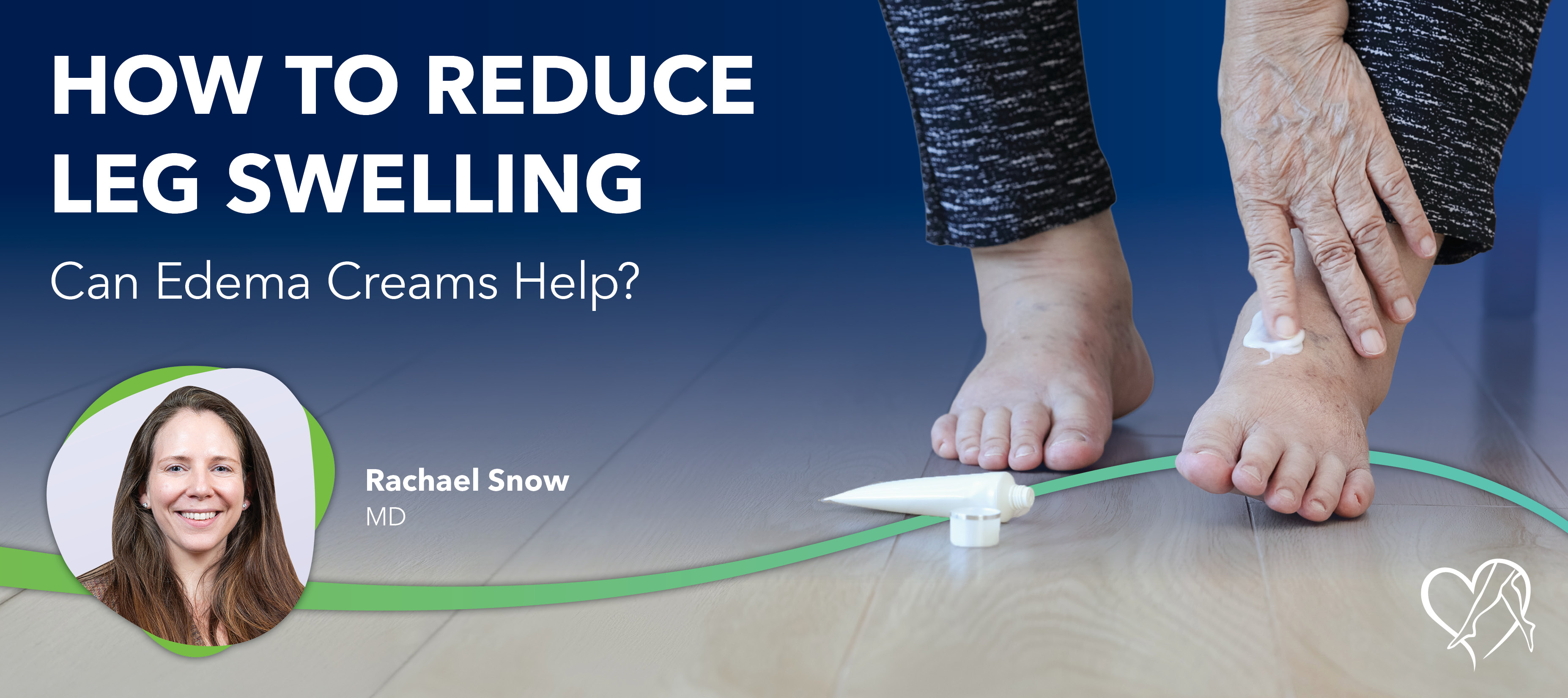 How to Reduce Leg Swelling: Can Edema Creams Help?