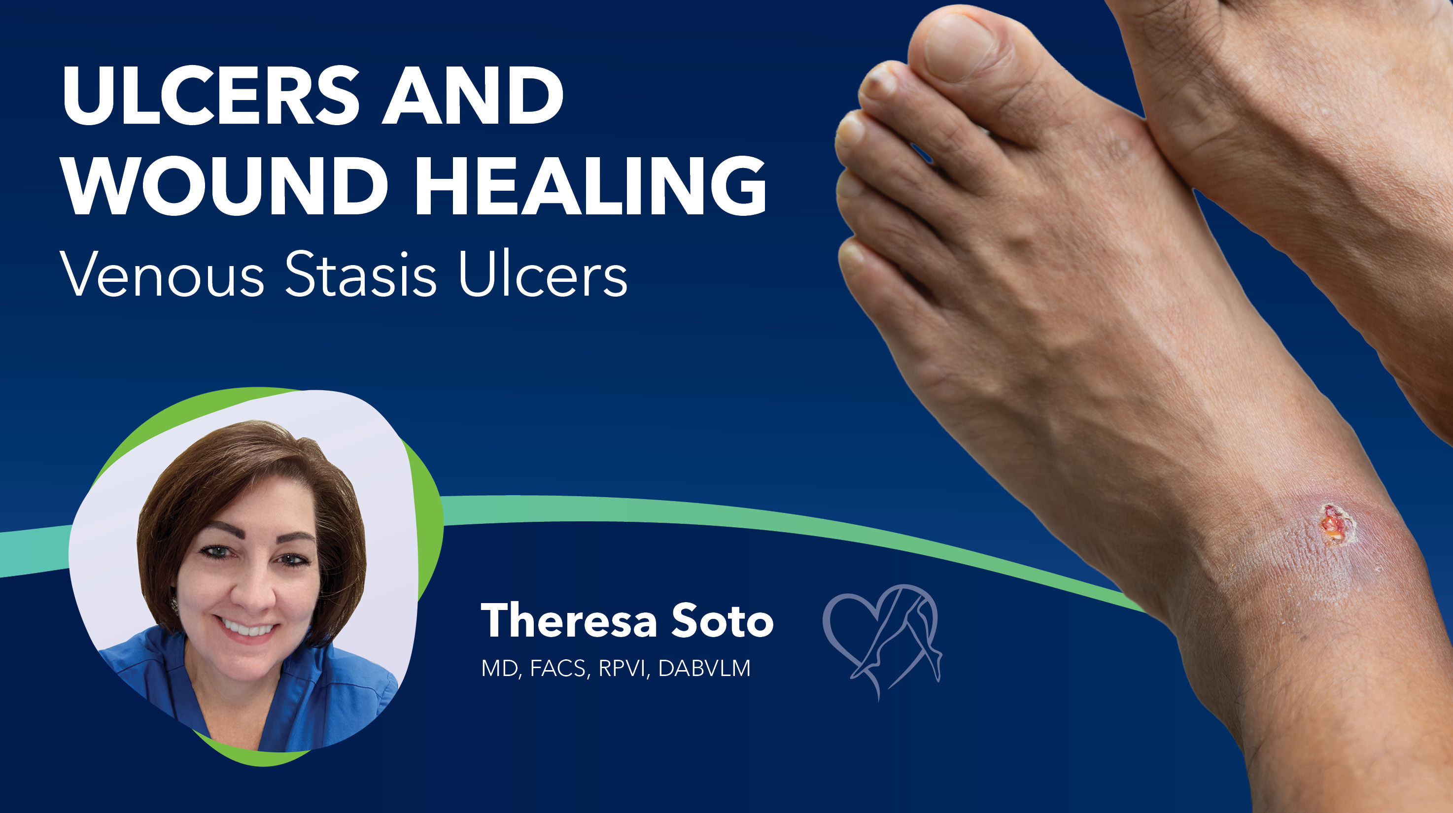 Arterial Ulcer vs. Venous Ulcer: What’s the Difference?