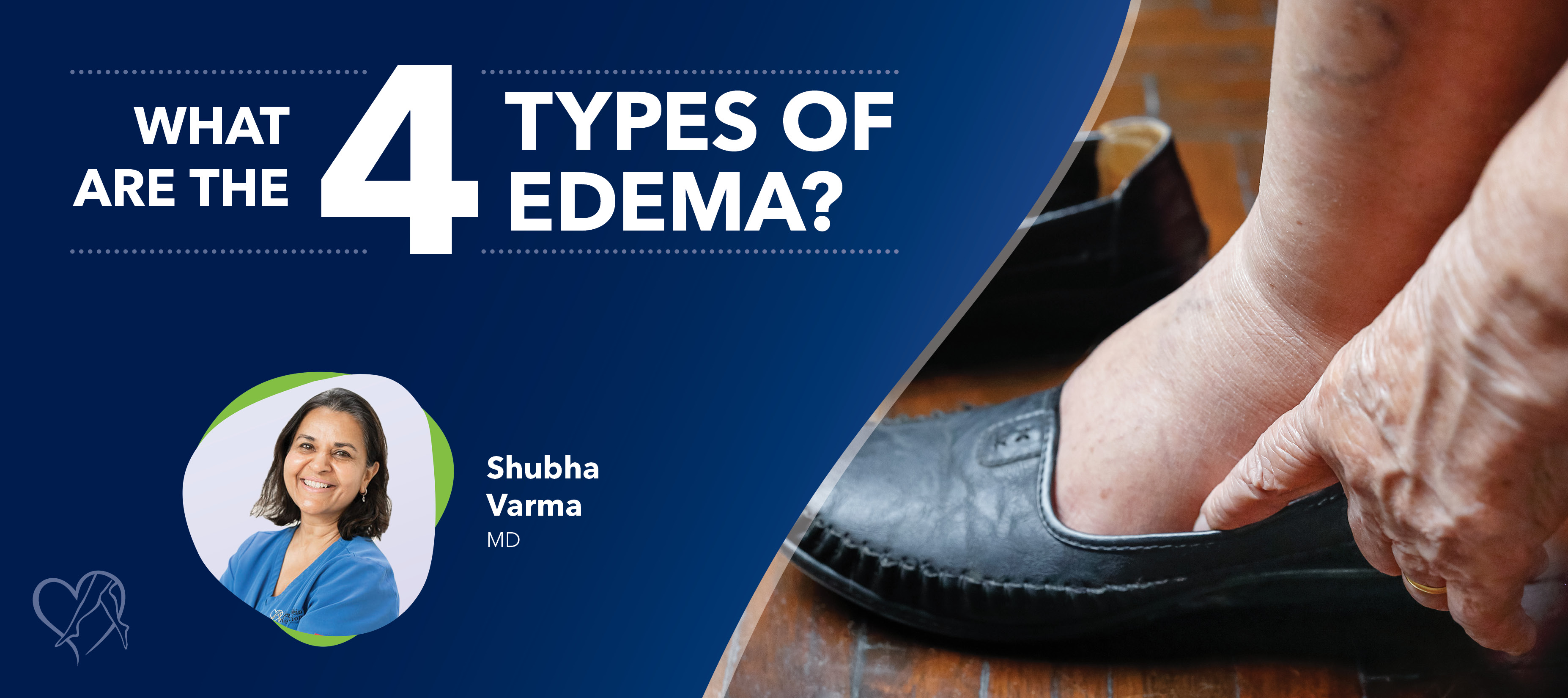 What Are The Four Types of Edema?