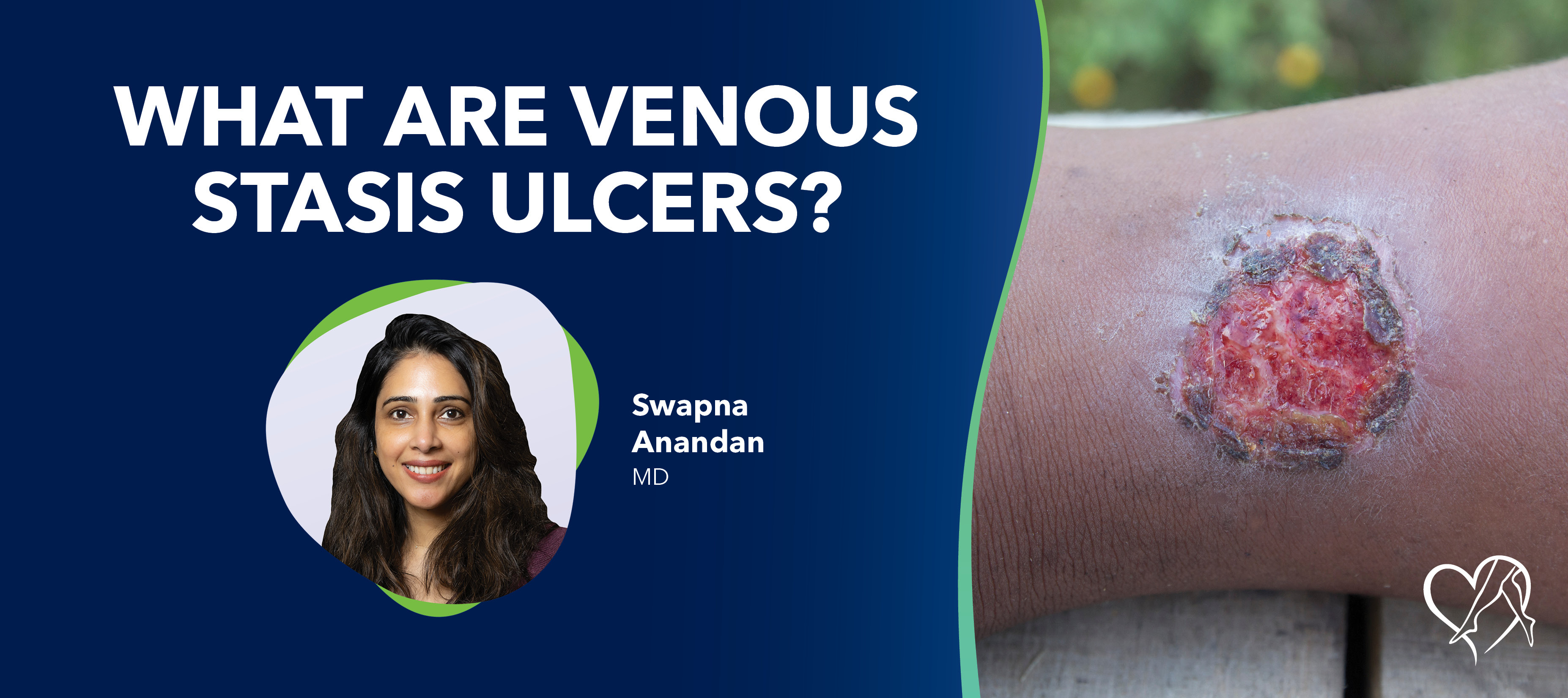 Center for Vein Restoration | ¿Qué son las Úlceras por Estasis Venosa?