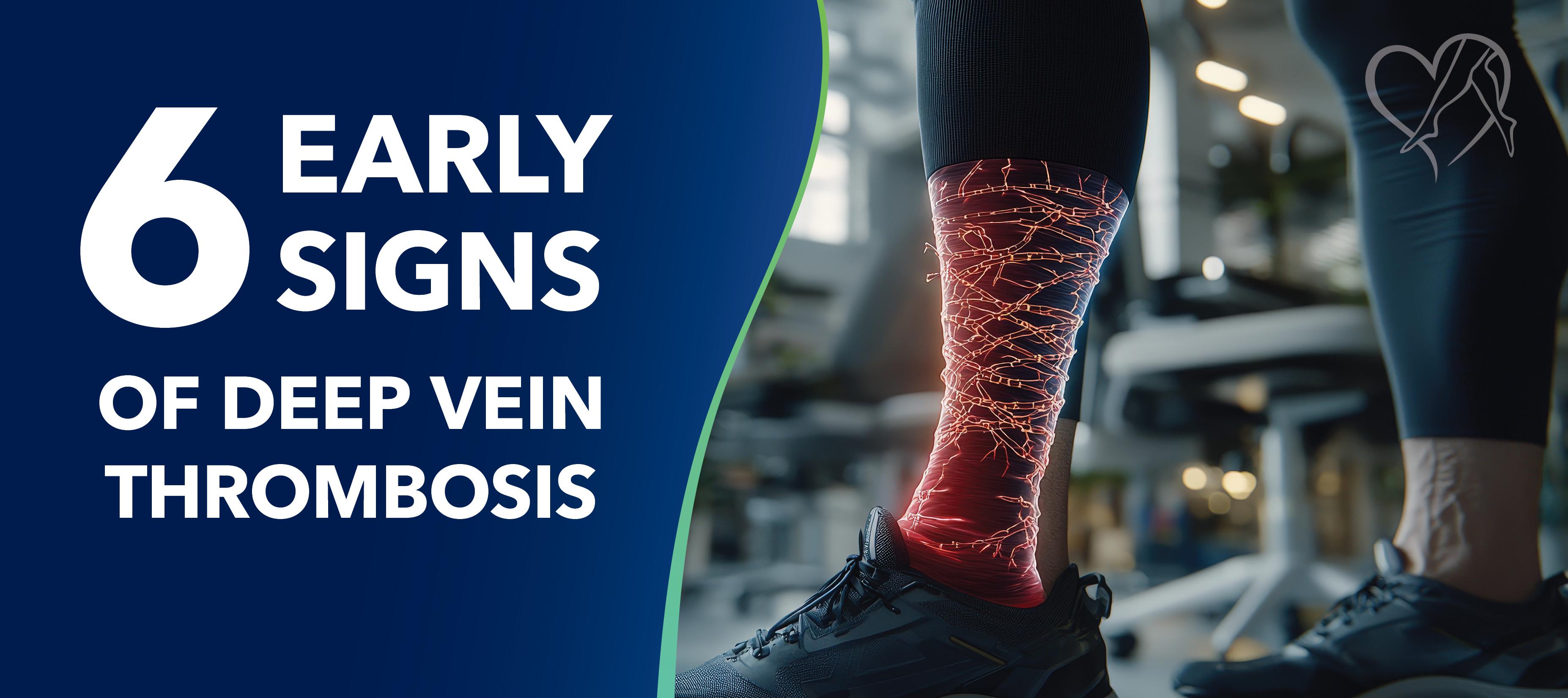 6 Early Signs of Deep Vein Thrombosis