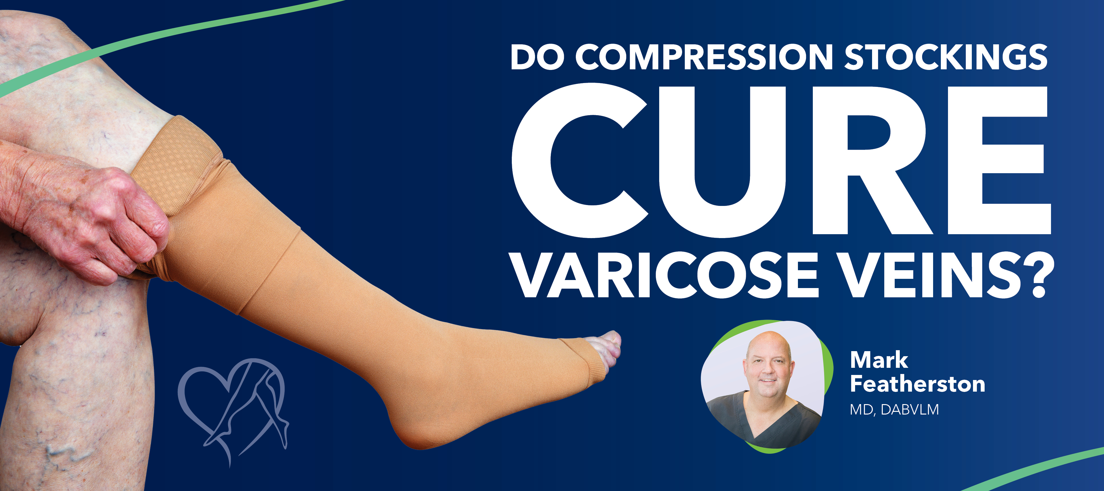 Do Compression Stockings Cure Varicose Veins?