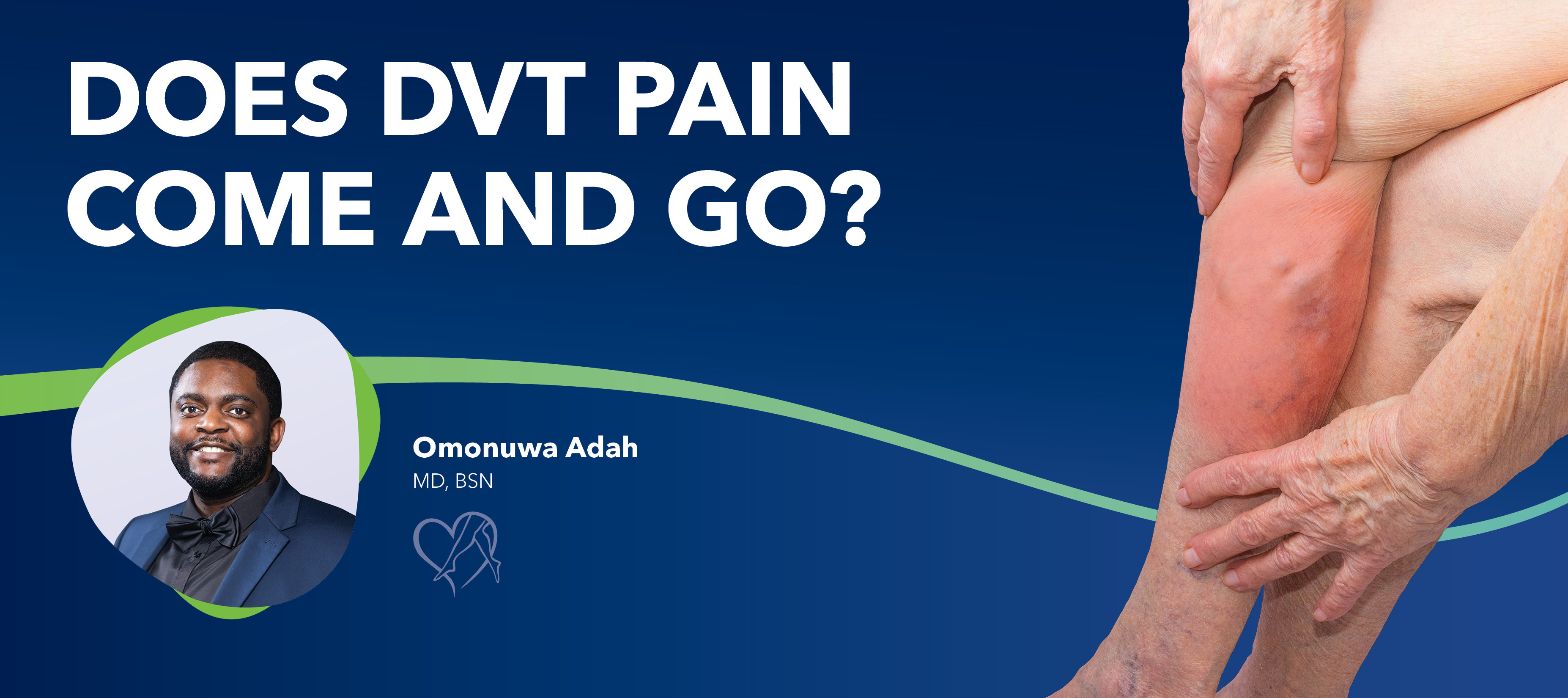 Does DVT Pain Come and Go?