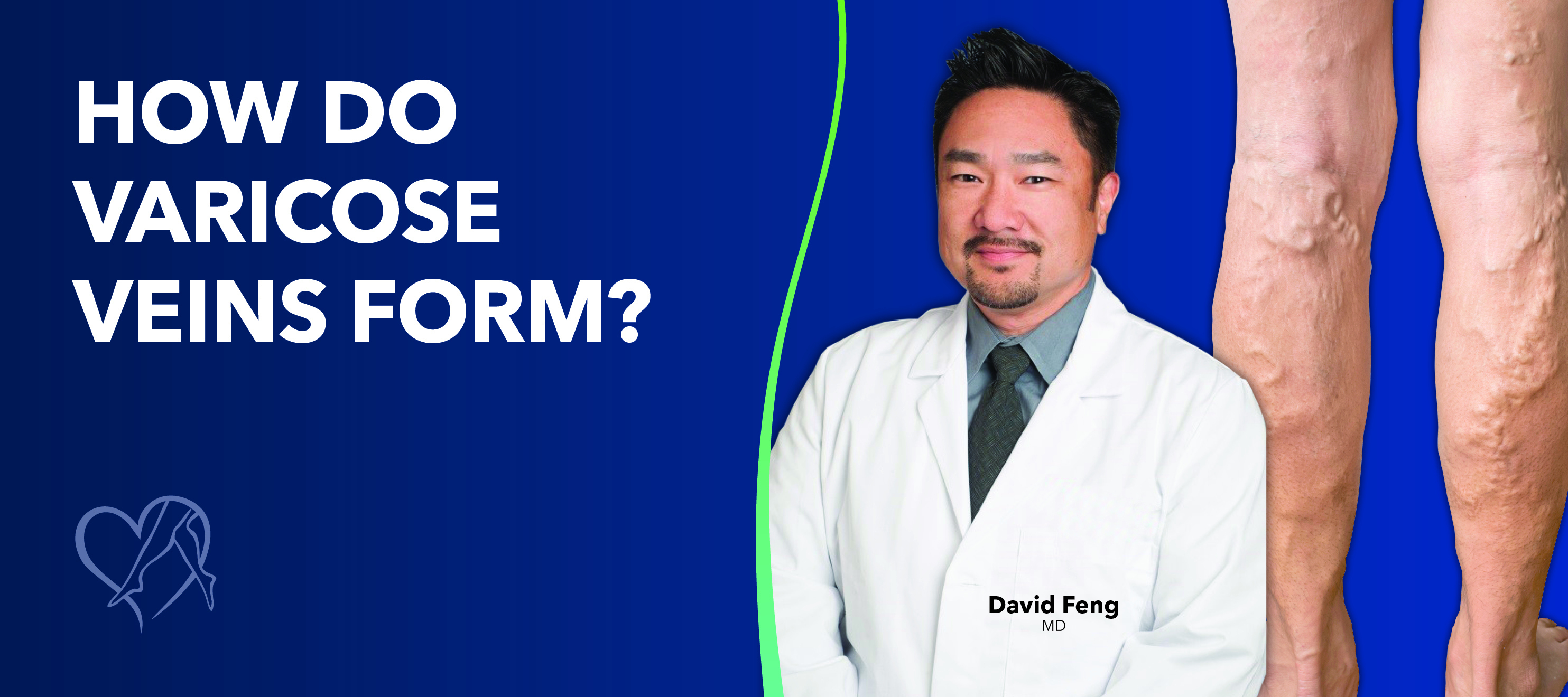 How Do Varicose Veins Form?