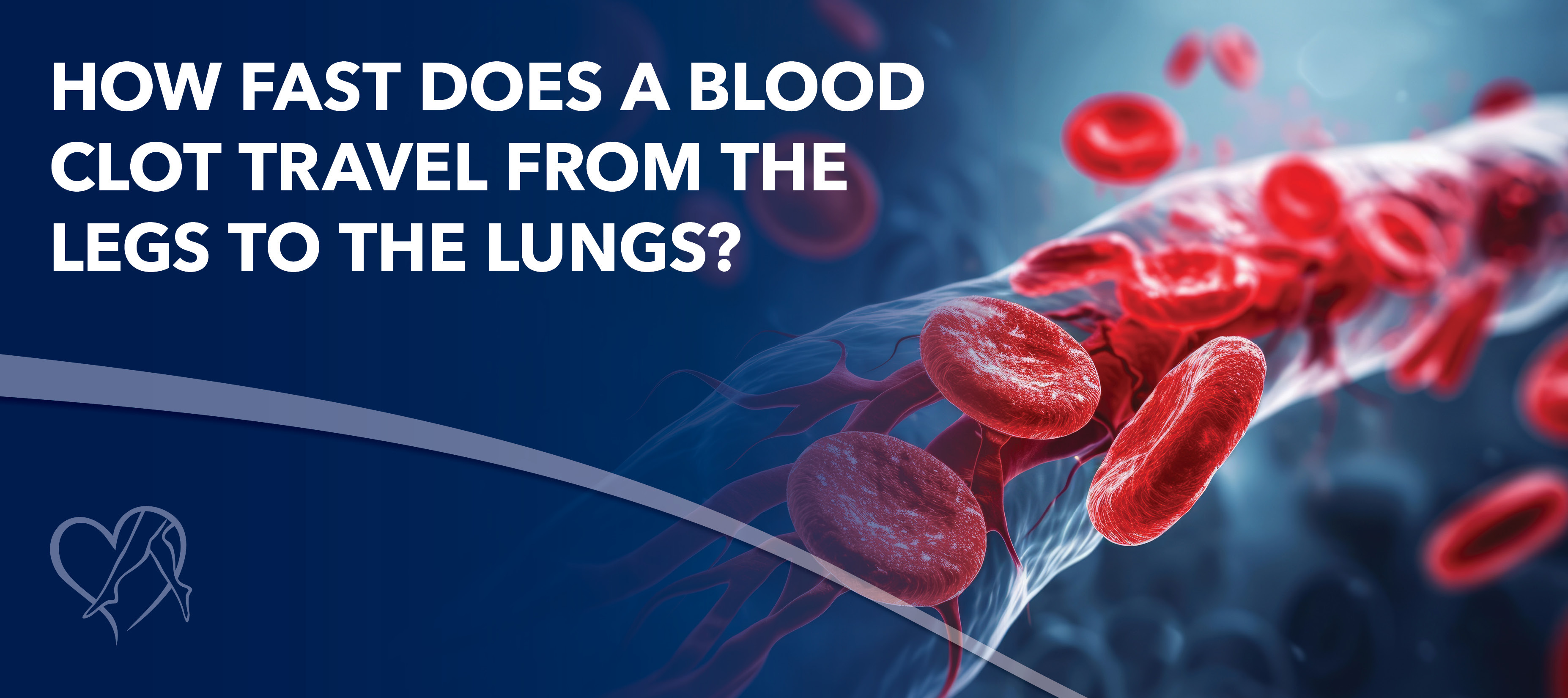 How Fast Does a Blood Clot Travel from the Legs to the Lungs?