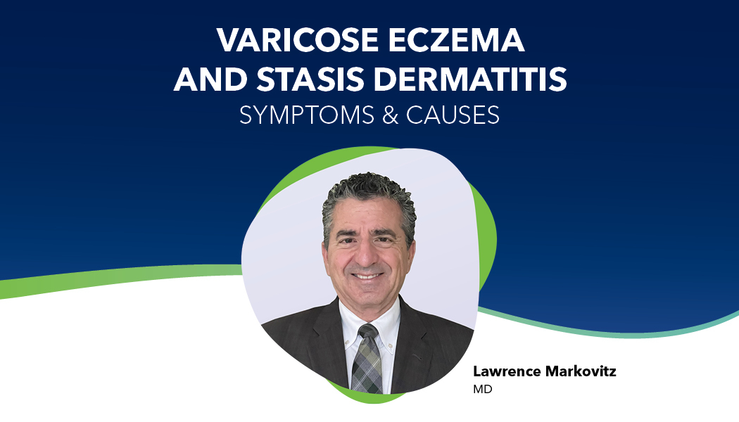 Center for Vein Restoration | Eccema varicoso y dermatitis por estasis ...