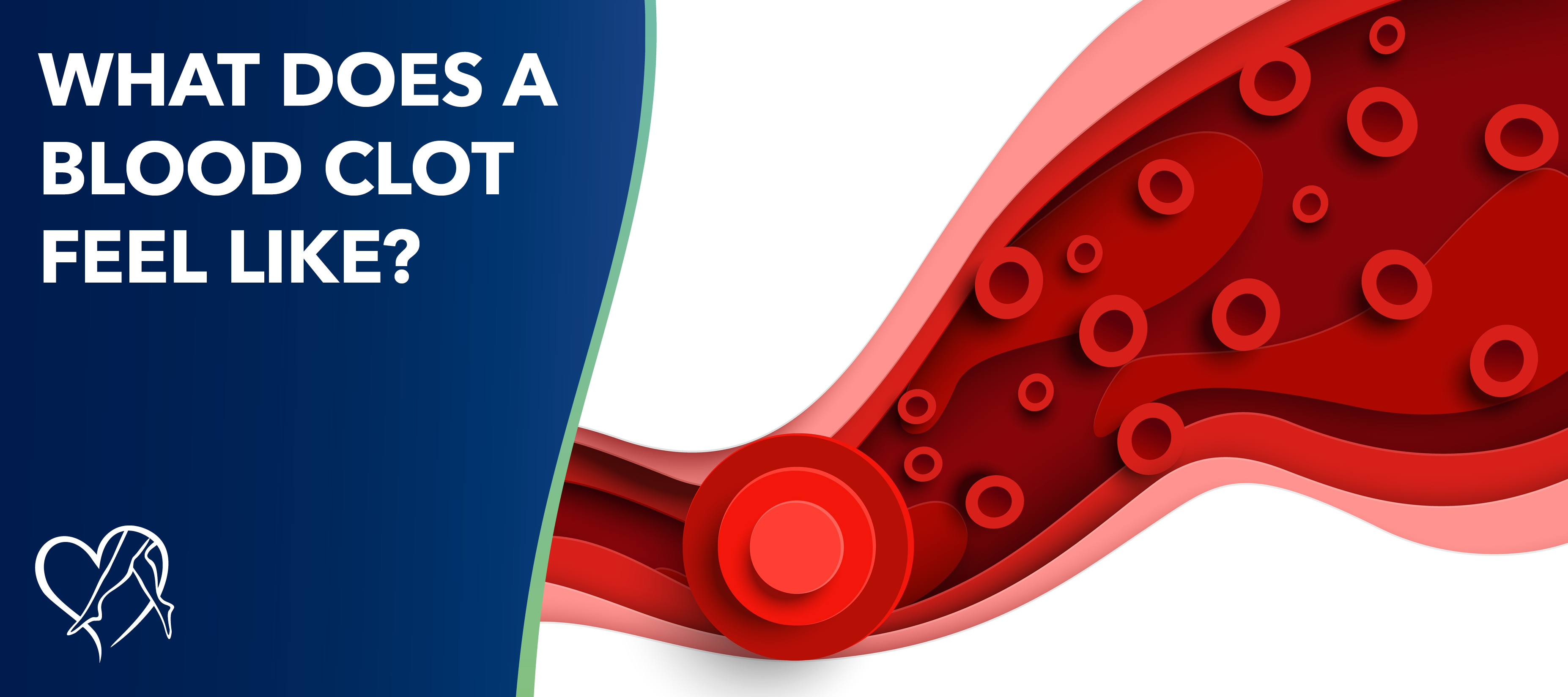 What Does a Blood Clot Feel Like?