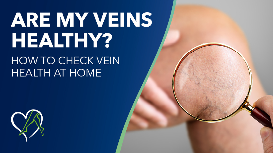 Are My Veins Healthy? How to Check Vein Health at Home